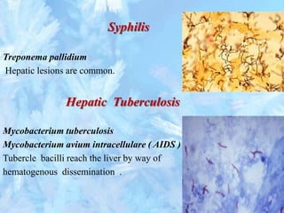 Microbiological aspect of liver | PPTX