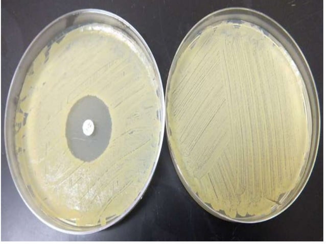 Microbiological assay of antibiotics | PPTX | Chemistry | Science
