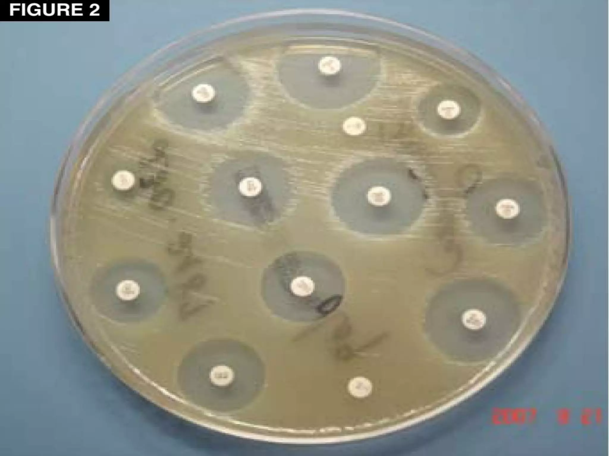 Microbiological culture sensitivity test | PPTX