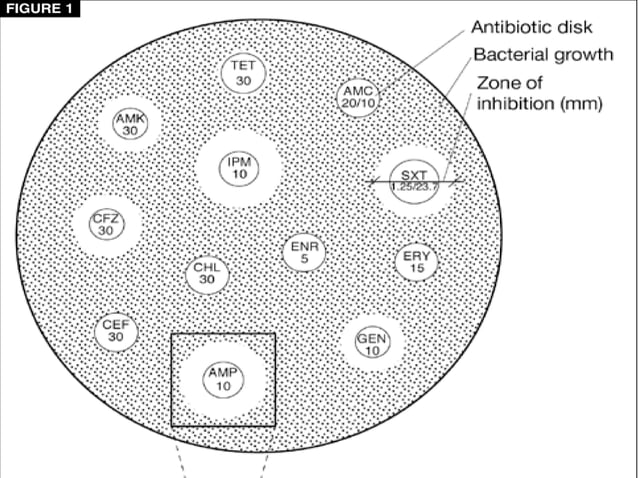 Microbiological culture sensitivity test | PPTX