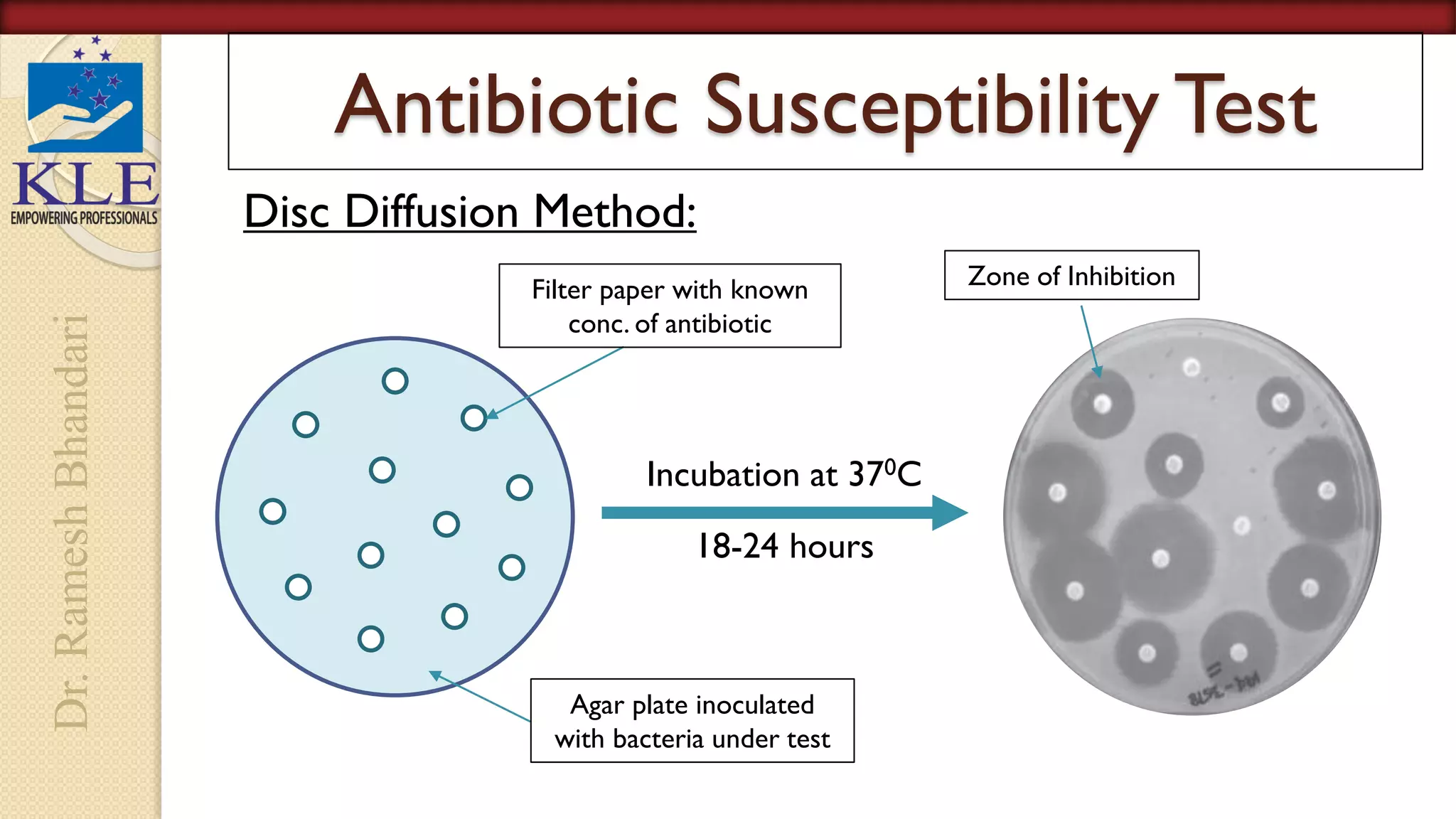 Microbiological culture sensitivity tests | PDF