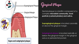 microbiologyy of the periodontium/gingiva | PDF