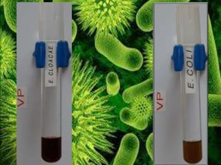 DEMONSTRATION OF METHYL RED AND VOGES-PROSKAUER TEST | PPTX