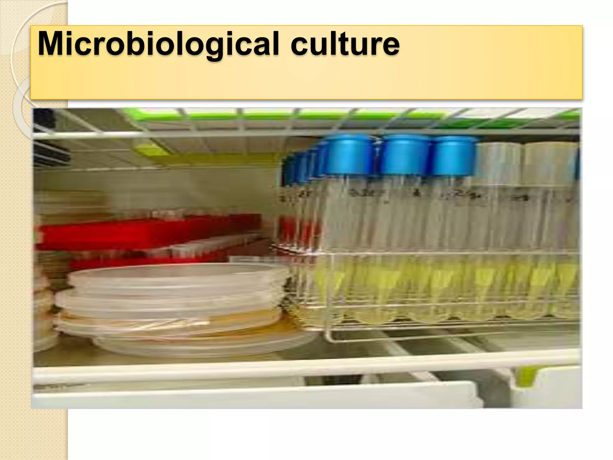Microbiological culture | PPTX