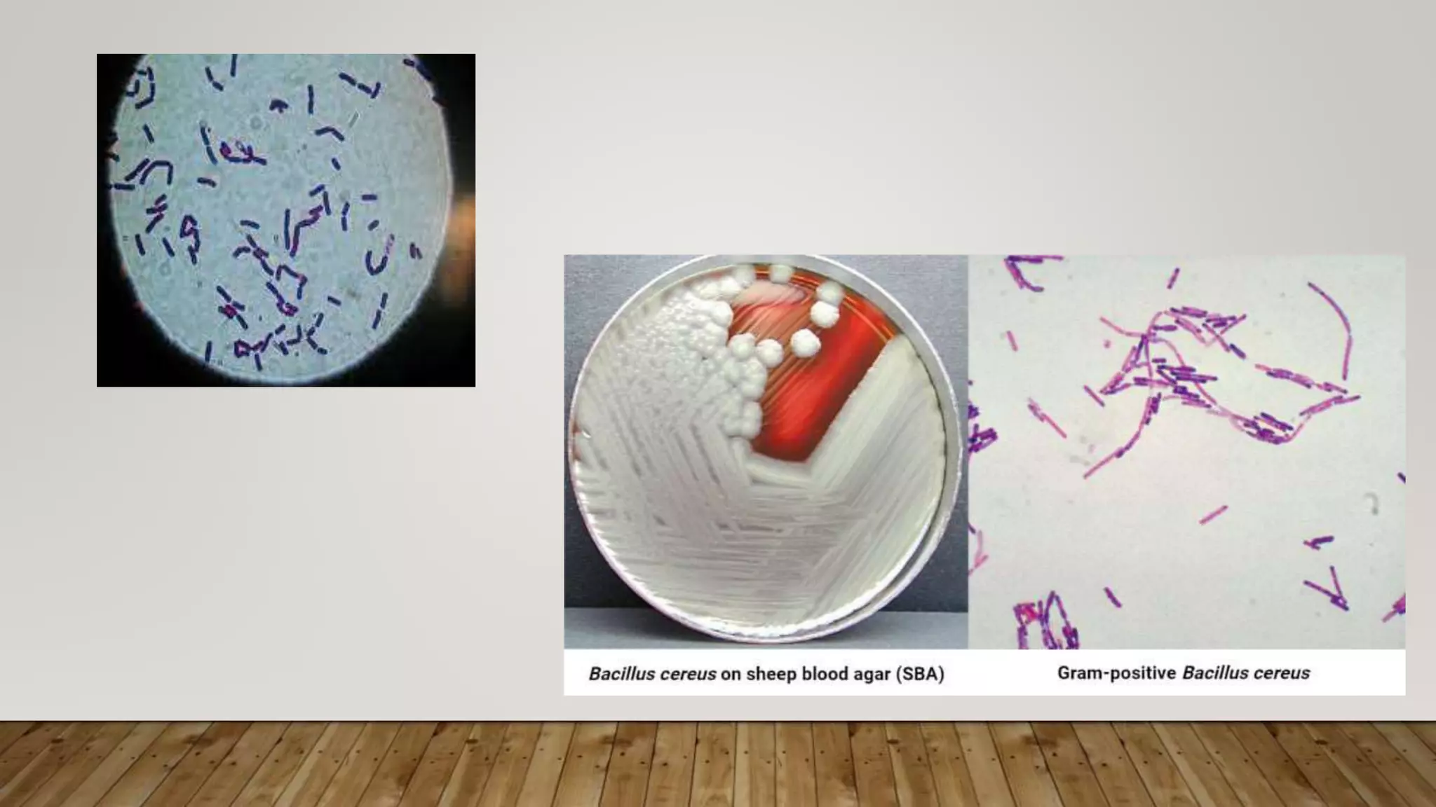 Microbiology bacillus cereus.pptx | Science