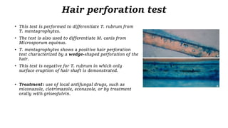 Medical Microbiology - Mycology | PPTX