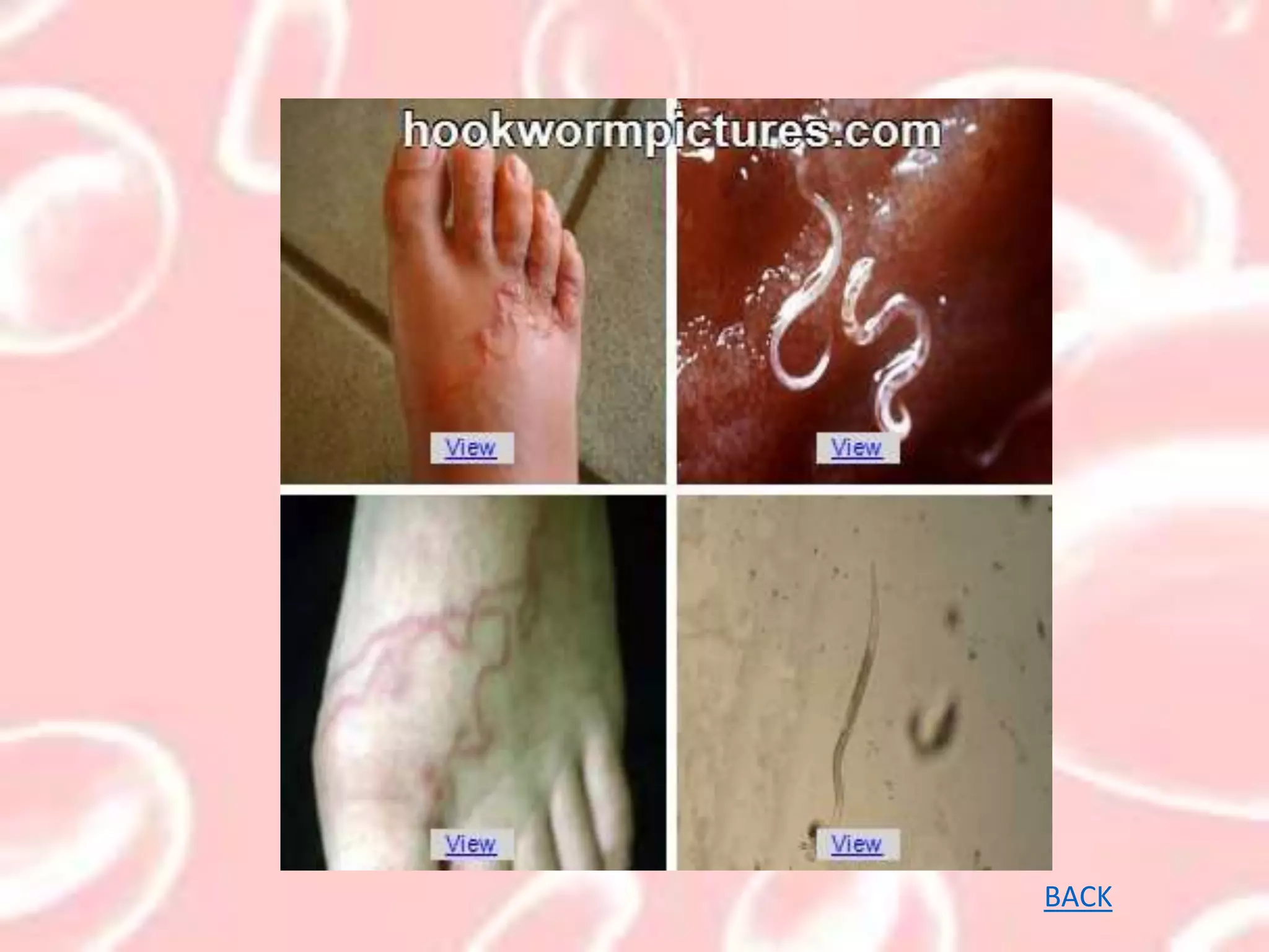 Microbiology2 Pathogens: Notes on spread of infectious disease | PPTX