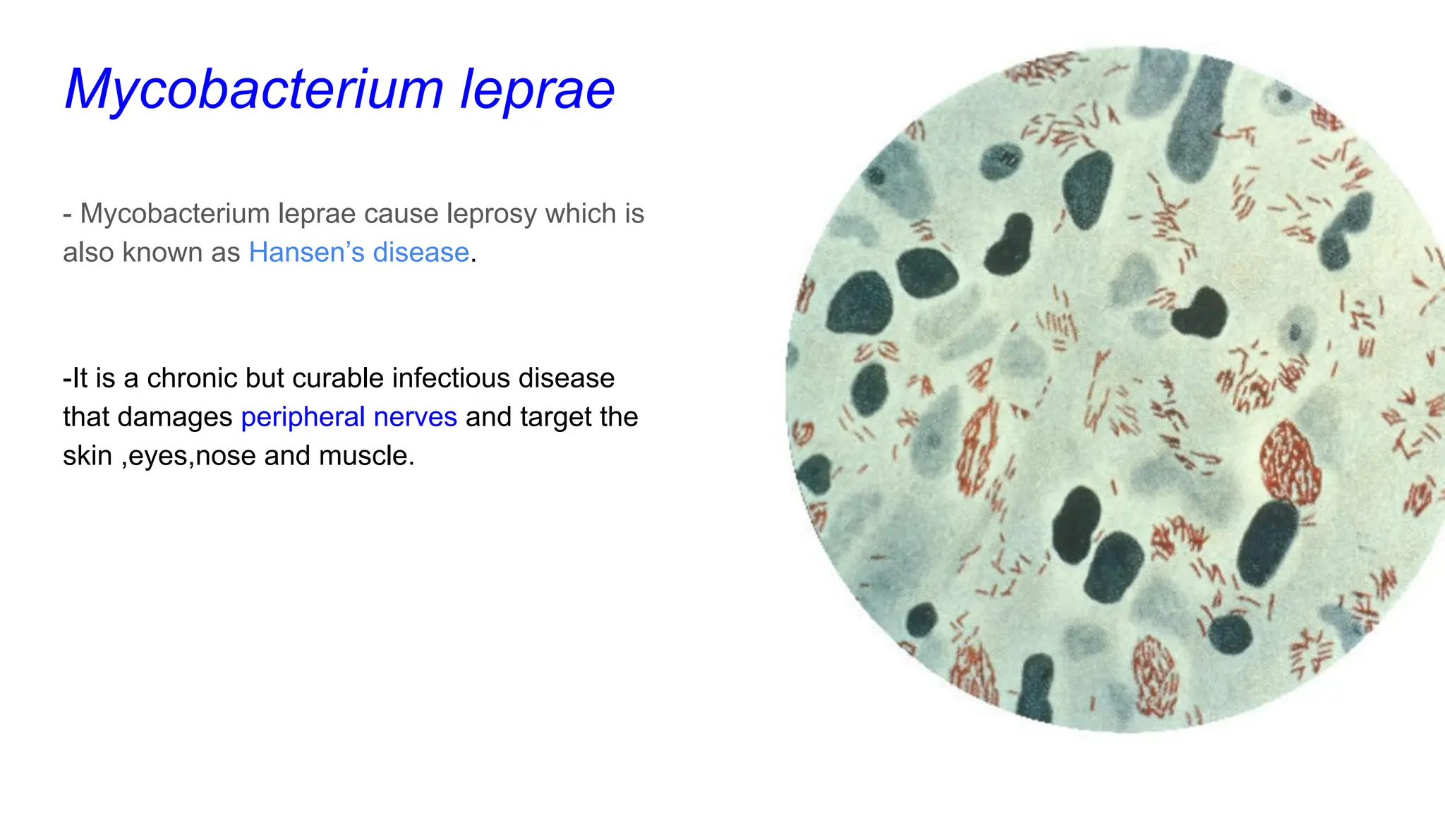 Microbiology and pathology of Leprosy .pdf