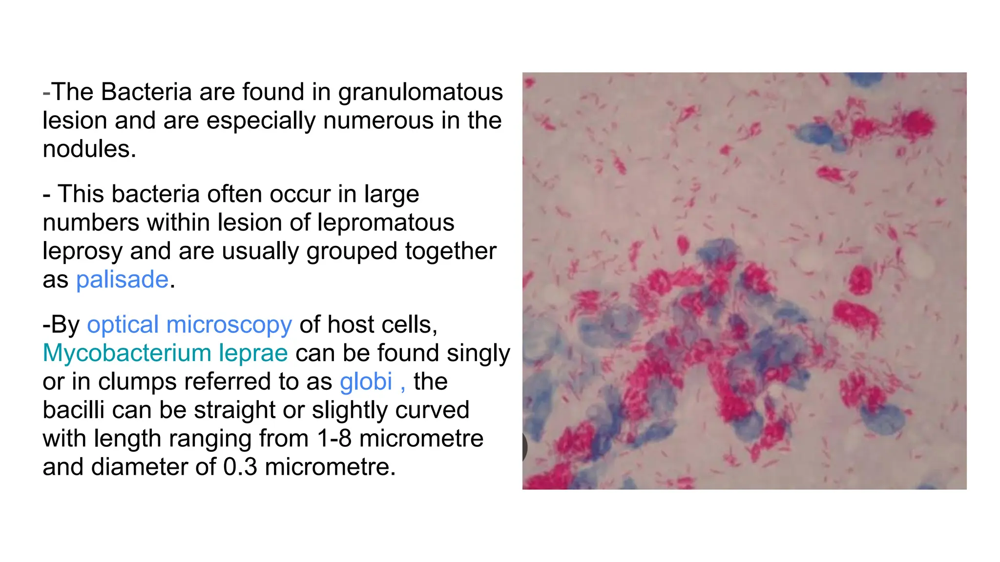 Microbiology and pathology of Leprosy .pdf