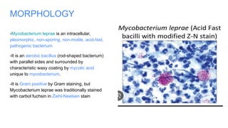 Microbiology and pathology of Leprosy .pdf