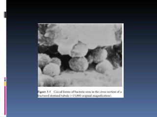 Microbiology aspect in endodontics | PPT