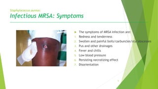Medical Microbiology - The lurking microbe : Staphylococcus aureus | PPT