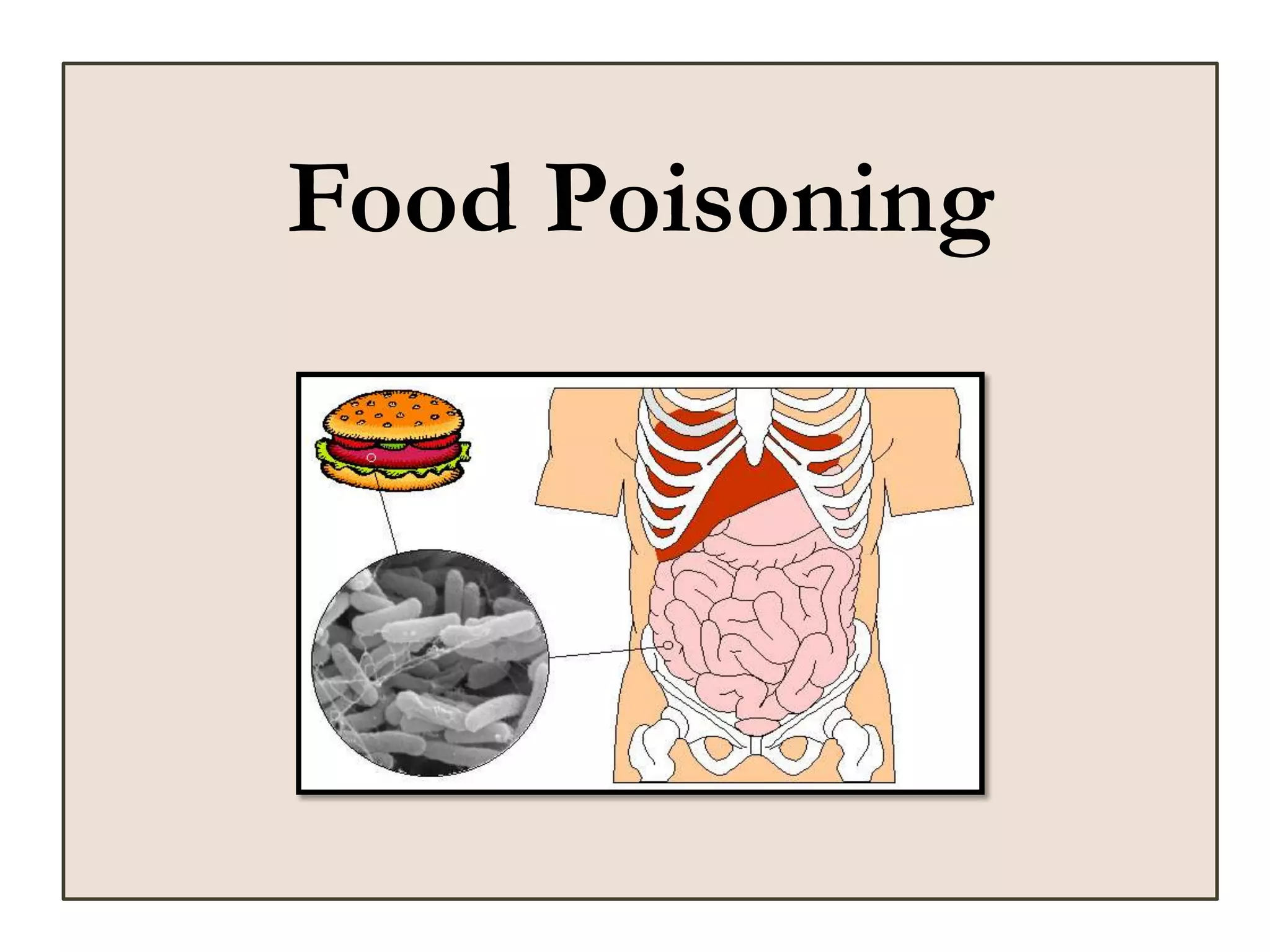 Microbiology food poisoning lecture | PPTX