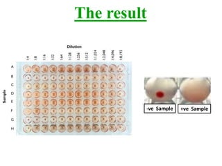 Microbiology (immunological method and application) | PPT