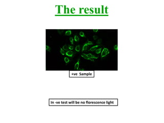 Microbiology (immunological method and application) | PPT
