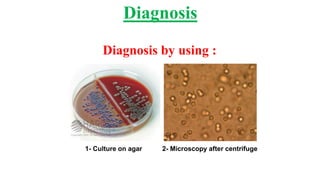 Microbiology (lab diagnosis of urinary tract infections) | PDF