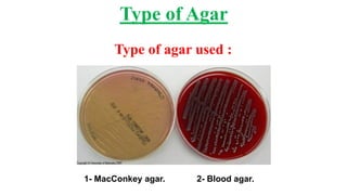 Microbiology (lab diagnosis of urinary tract infections) | PDF