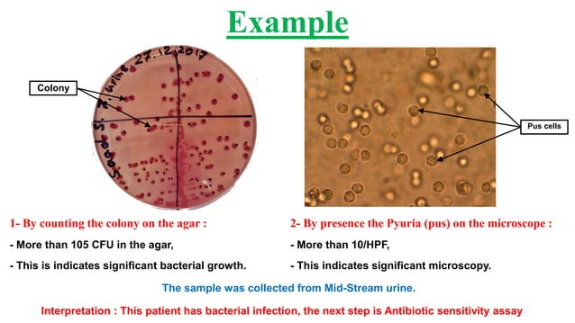 Microbiology (lab diagnosis of urinary tract infections) | PDF