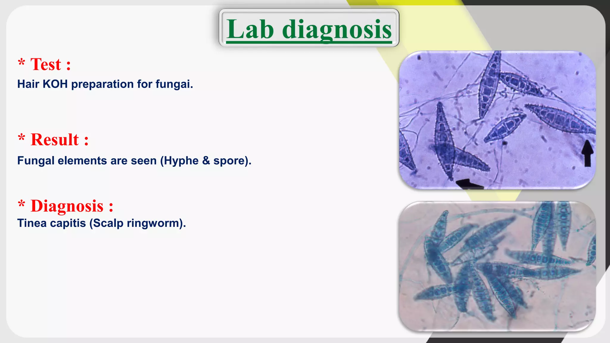 Microbiology (lab diagnosis result of fungal and bacterial skin ...