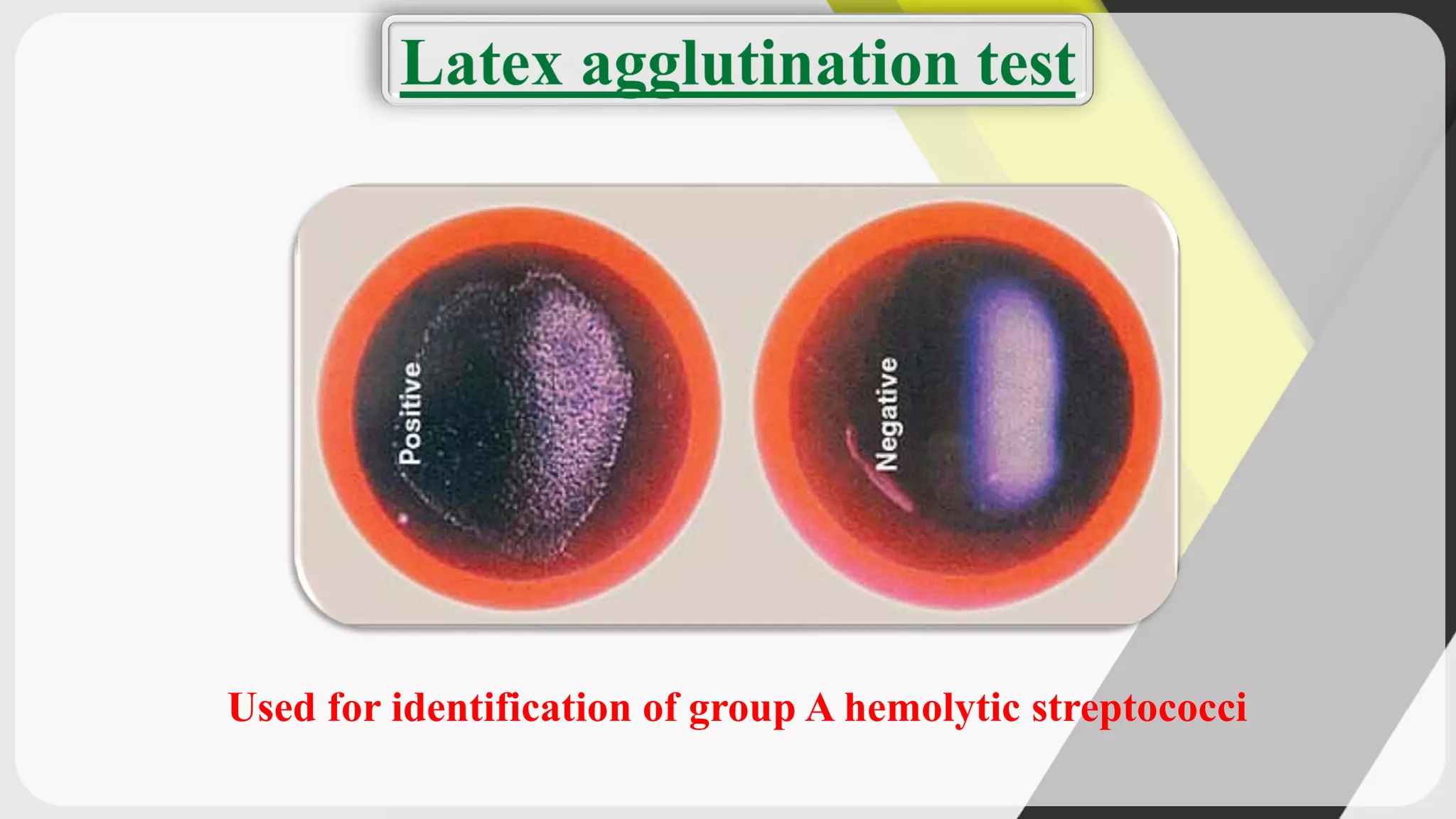 Microbiology (lab diagnosis result of fungal and bacterial skin ...