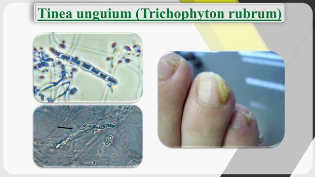 Microbiology (lab diagnosis result of fungal and bacterial skin ...