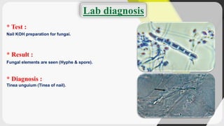 Microbiology (lab diagnosis result of fungal and bacterial skin ...