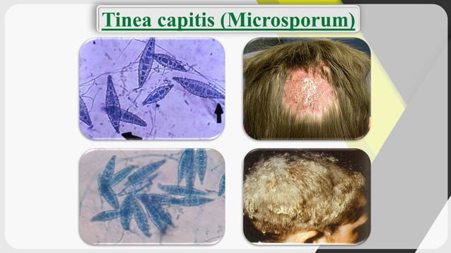 Microbiology (lab diagnosis result of fungal and bacterial skin ...