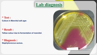 Microbiology (lab diagnosis result of fungal and bacterial skin ...