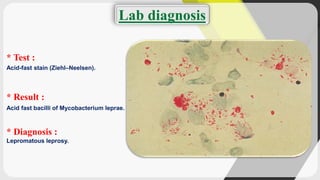Microbiology (lab diagnosis result of fungal and bacterial skin ...
