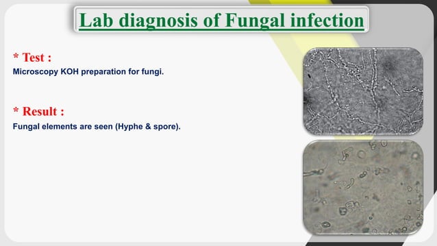 Microbiology (lab diagnosis result of fungal and bacterial skin ...