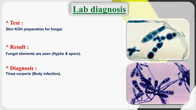 Microbiology (lab diagnosis result of fungal and bacterial skin ...