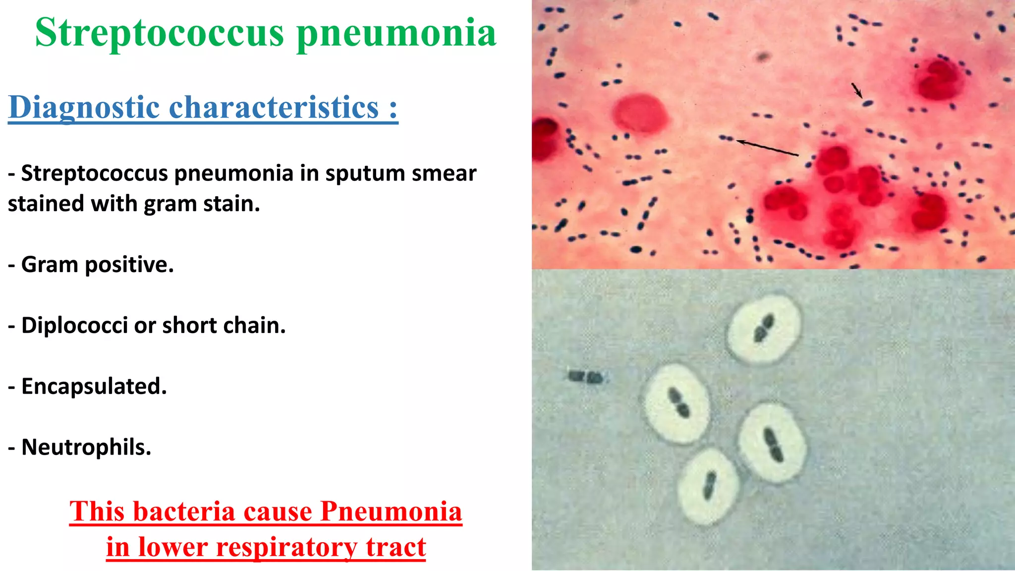 Microbiology (laboratory diagnosis of respiratory tract infections) | PDF