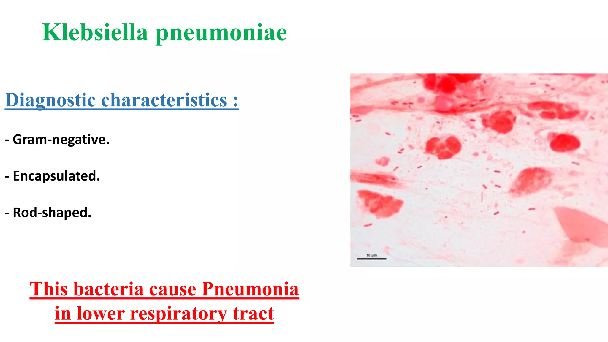 Microbiology (laboratory diagnosis of respiratory tract infections) | PDF