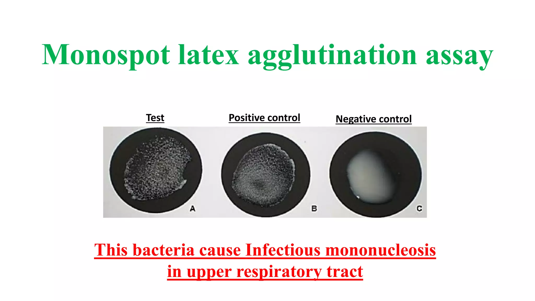 Microbiology (laboratory diagnosis of respiratory tract infections) | PDF