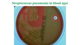 Microbiology (laboratory diagnosis of respiratory tract infections) | PDF