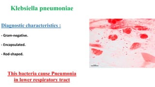 Microbiology (laboratory diagnosis of respiratory tract infections) | PDF
