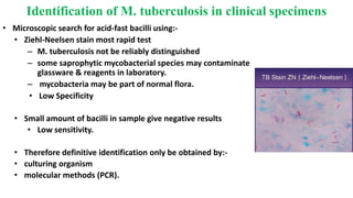 Microbiology (laboratory diagnosis of respiratory tract infections) | PDF
