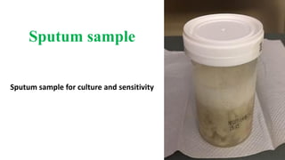 Microbiology (laboratory diagnosis of respiratory tract infections) | PDF