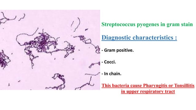 Microbiology (laboratory diagnosis of respiratory tract infections ...