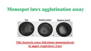 Microbiology (laboratory diagnosis of respiratory tract infections) | PDF