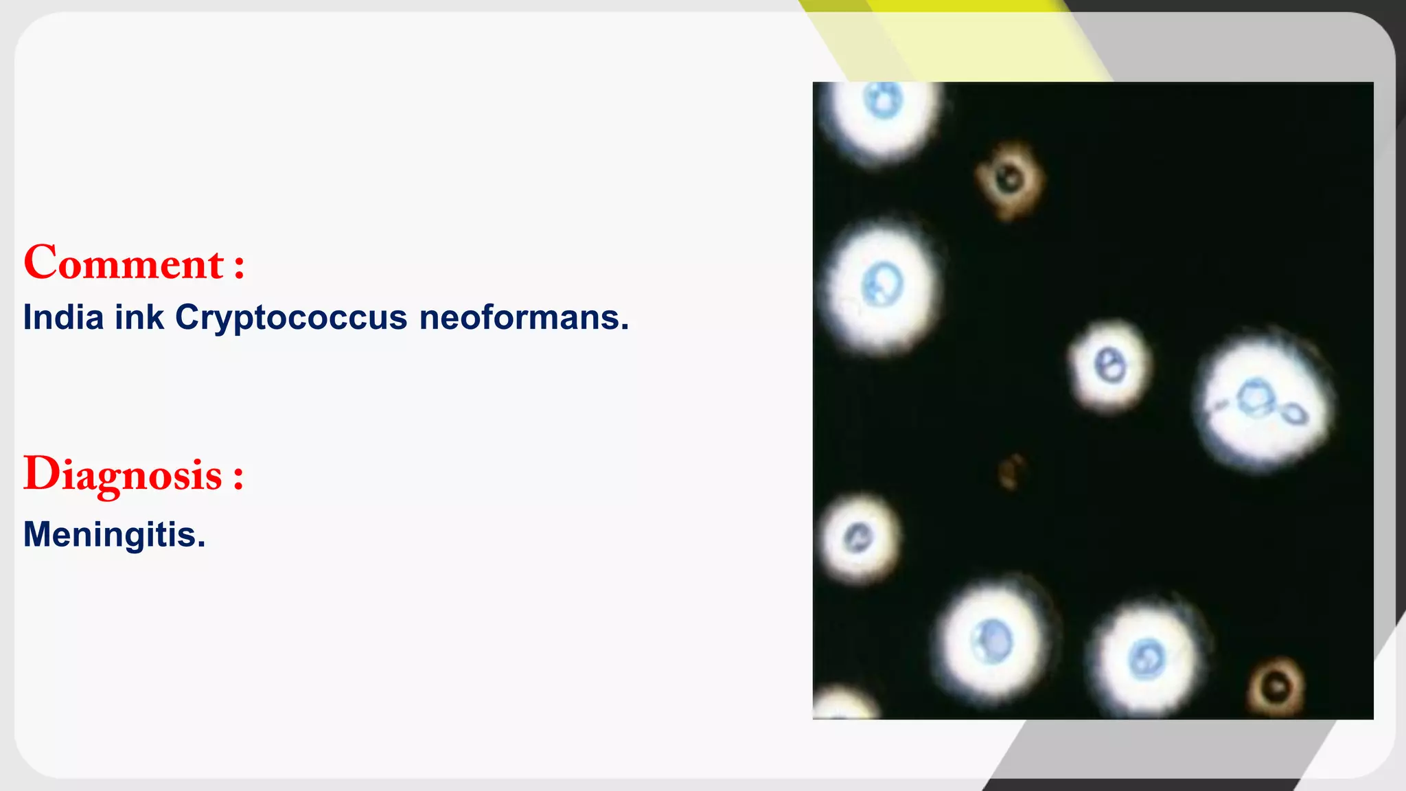 Microbiology (laboratory examination of csf) | PDF