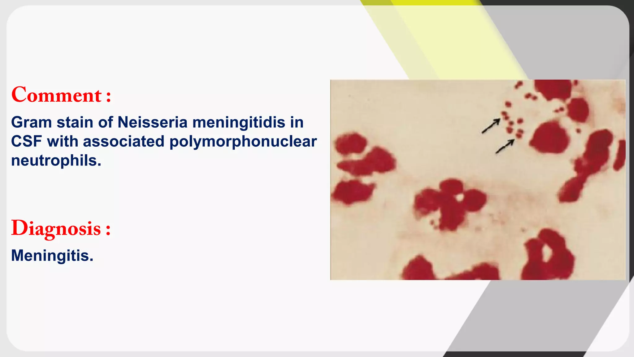 Microbiology (laboratory examination of csf) | PDF