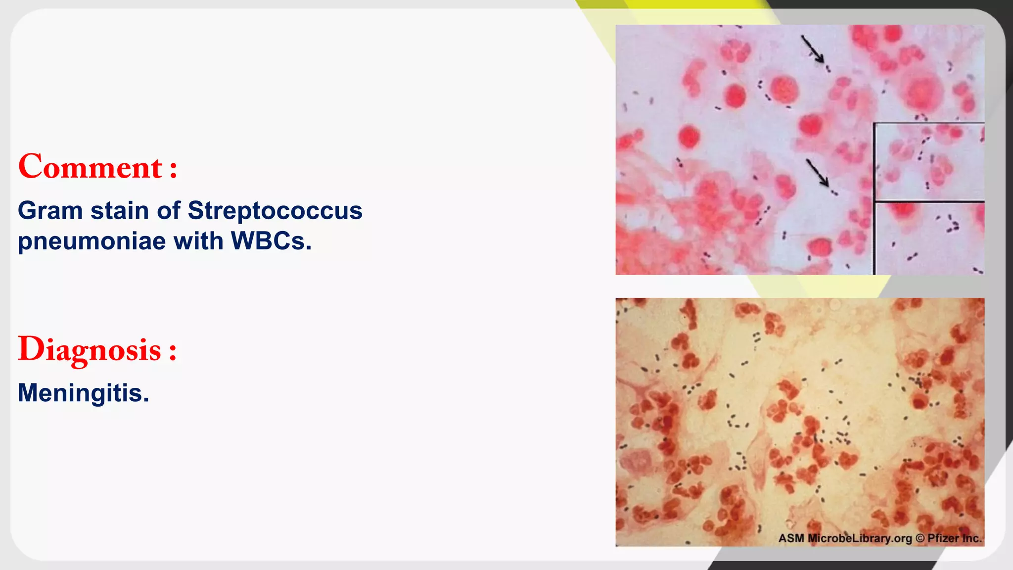 Microbiology (laboratory examination of csf) | PDF