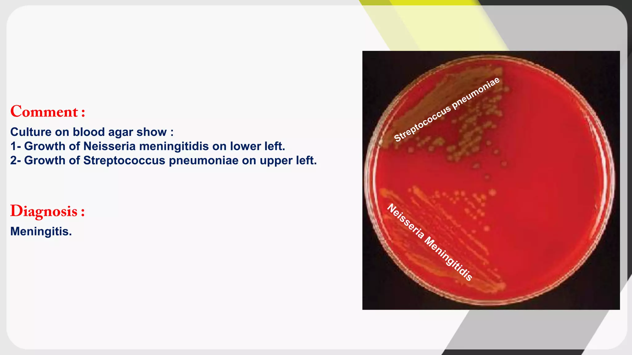 Microbiology (laboratory examination of csf) | PDF