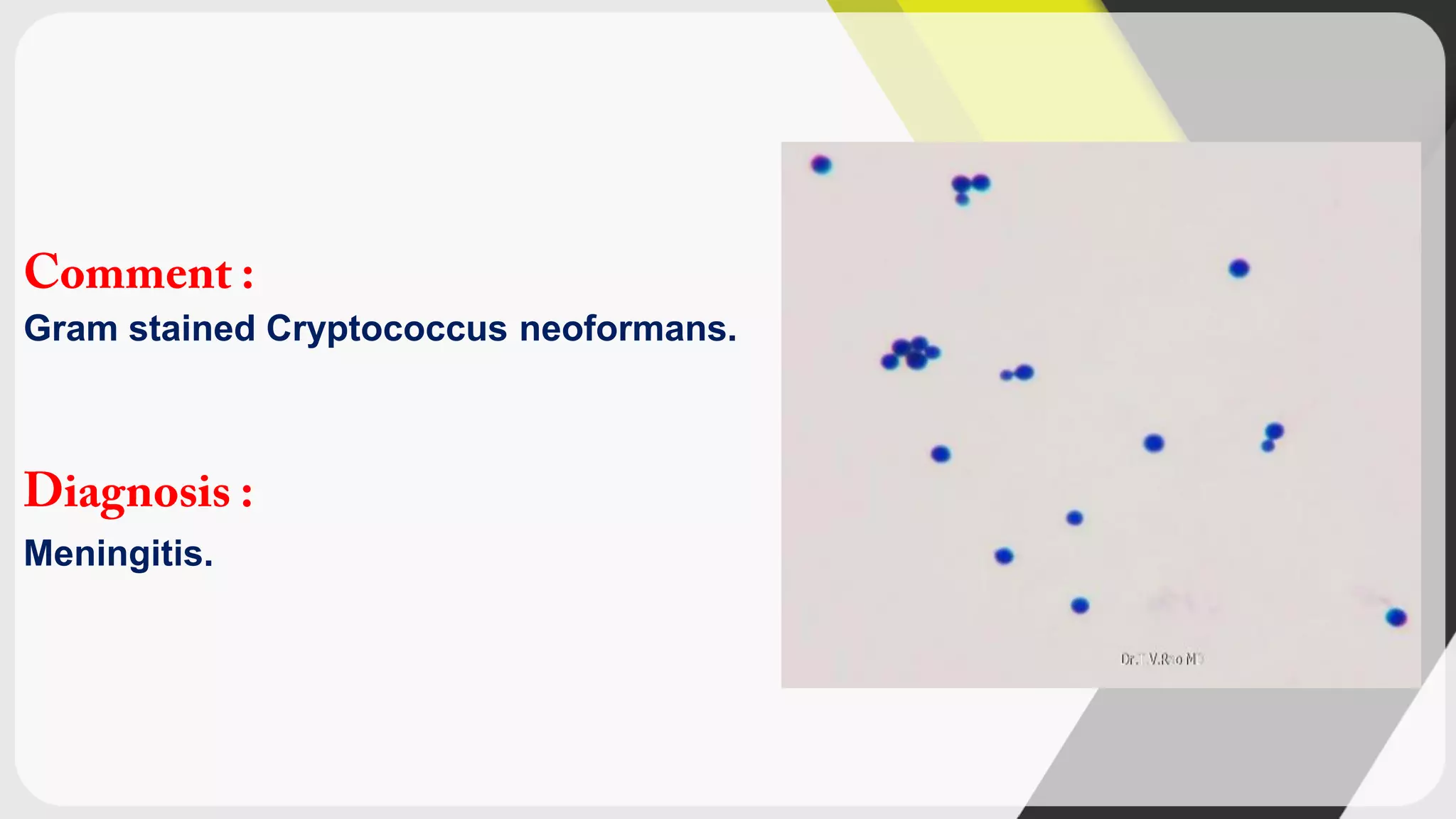 Microbiology (laboratory examination of csf) | PDF