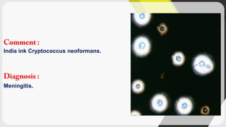 Microbiology (laboratory examination of csf) | PDF