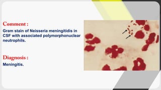 Microbiology (laboratory examination of csf) | PDF