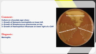 Microbiology (laboratory examination of csf) | PDF