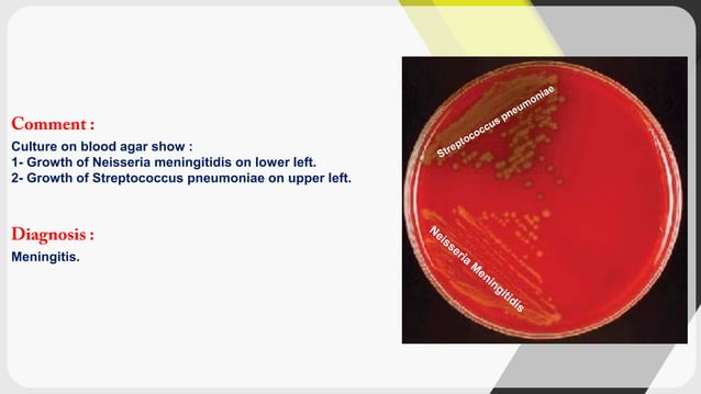 Microbiology (laboratory examination of csf) | PDF