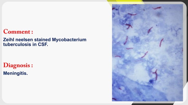 Microbiology (laboratory examination of csf) | PDF